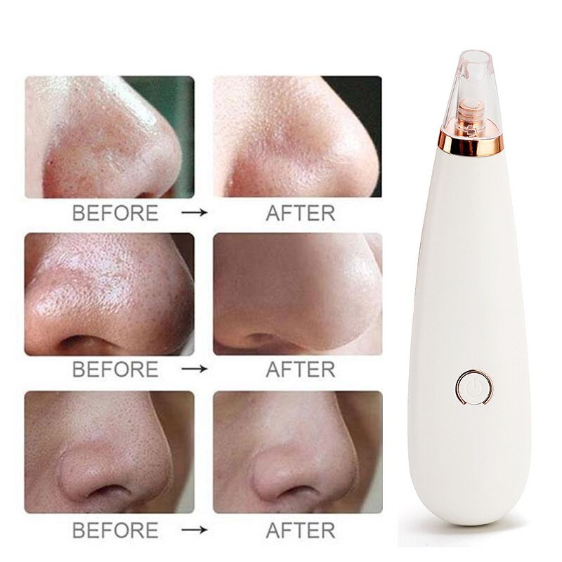 Blackhead Remover T Zone Pore Acne Pimple Removal ... – Grandado