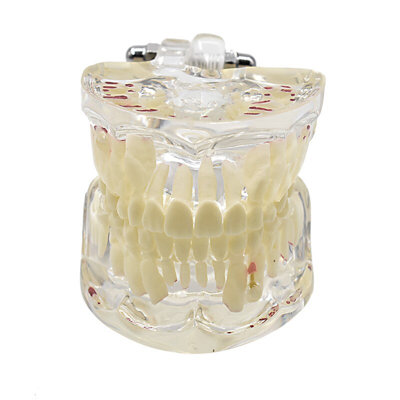 Dental Teeth Model Children Baby Pathology Teeth M... – Grandado