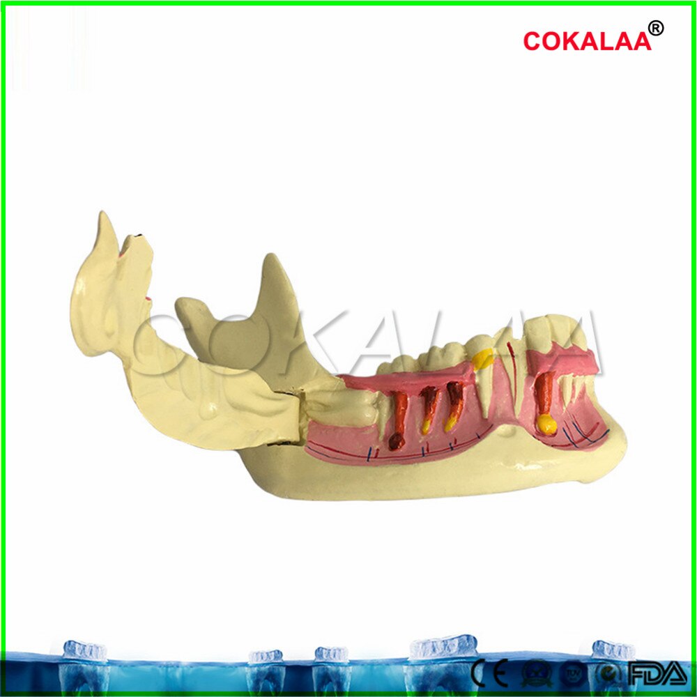Good Mandibular tissue decomposition model dental ... – Vicedeal