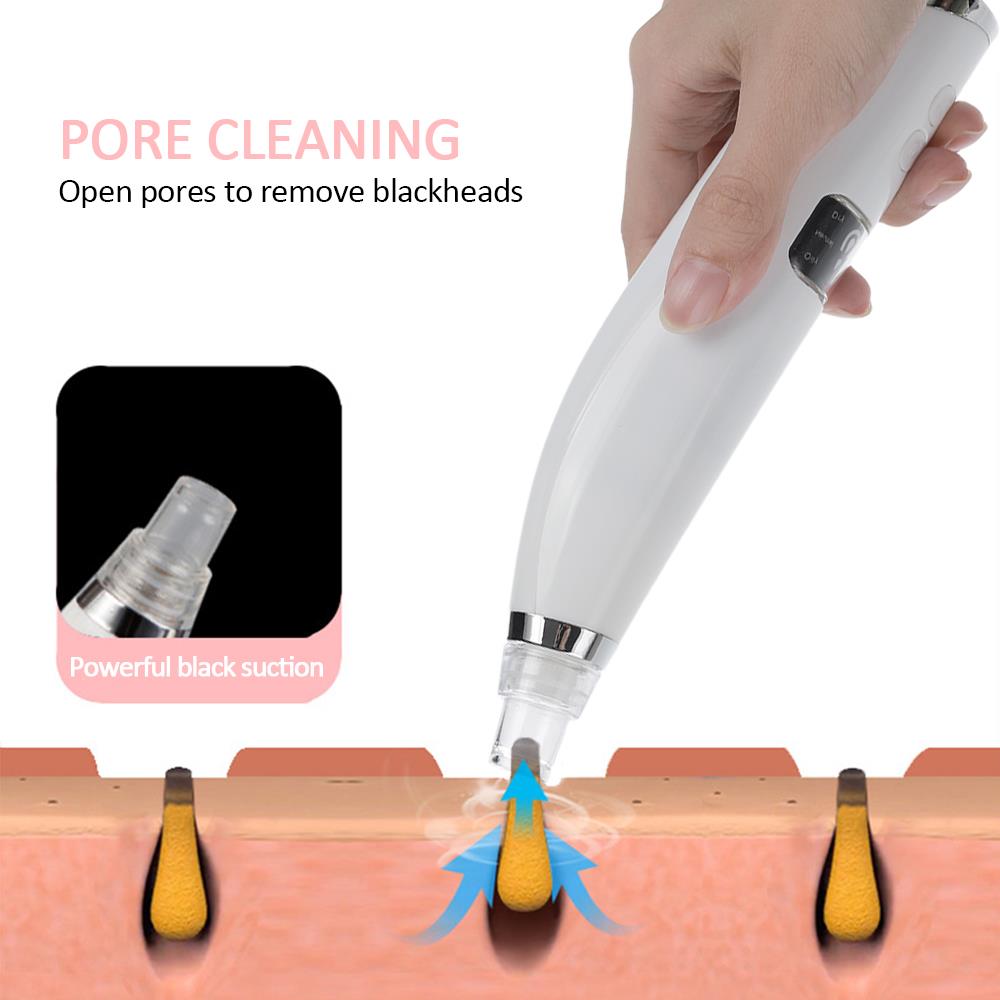Remove Blackhead Clear Black Head Cleaner Blackhea... – Grandado
