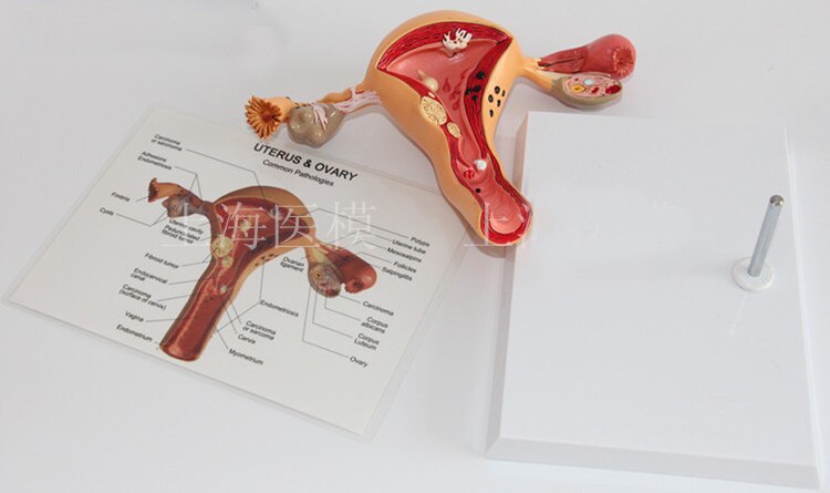 BAARMOEDER & EIERSTOK common pathologieën Baar... – Vicedeal