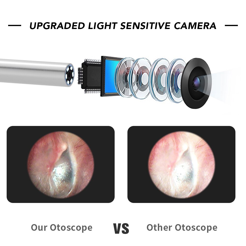 TESLONG 3 in 1 Ear Endoscope Camera 4.3mm Ear Clea... – Grandado