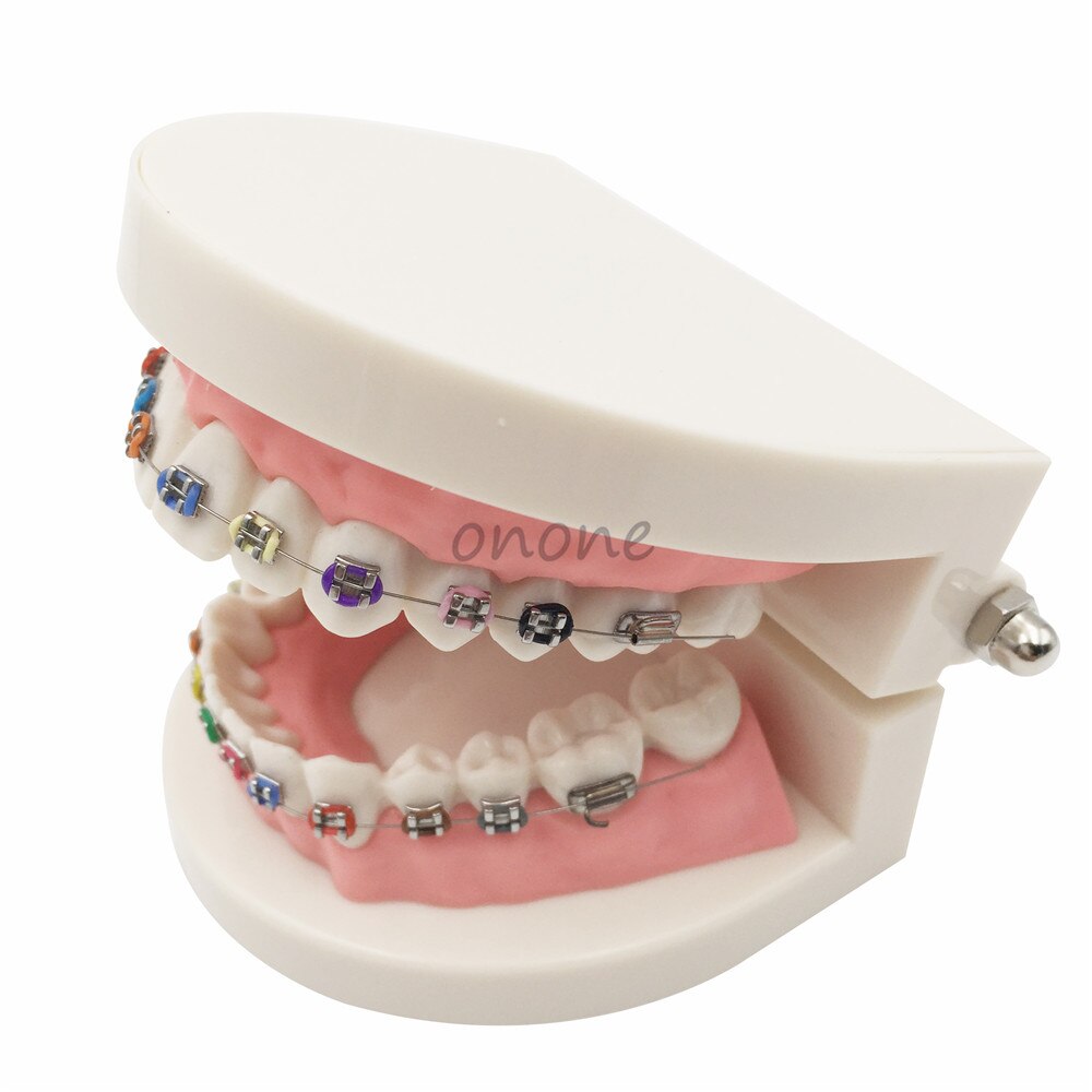 1pcs Orthodontics Model for Dentist Dental 1/2 Sta... – Vicedeal