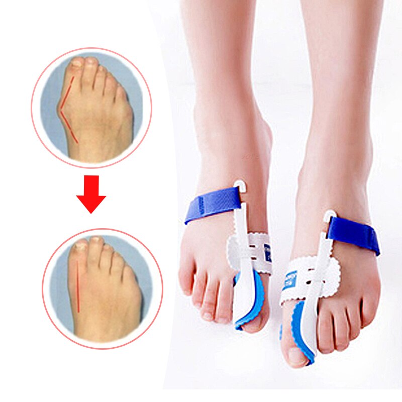 Bunion Device Hallux Valgus Orthopedic Braces Toe ... – Grandado