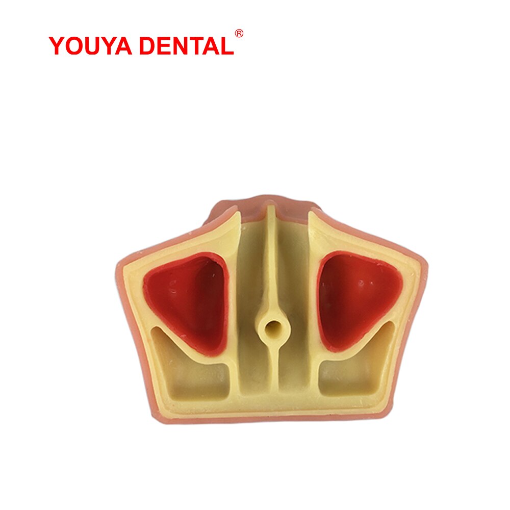 Dental Model Teeth Implant Practice Model Maxillar... – Grandado