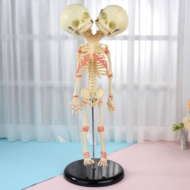 37 Cm Menselijk Dubbele Hoofd Baby Schedel Skelet ... – Vicedeal