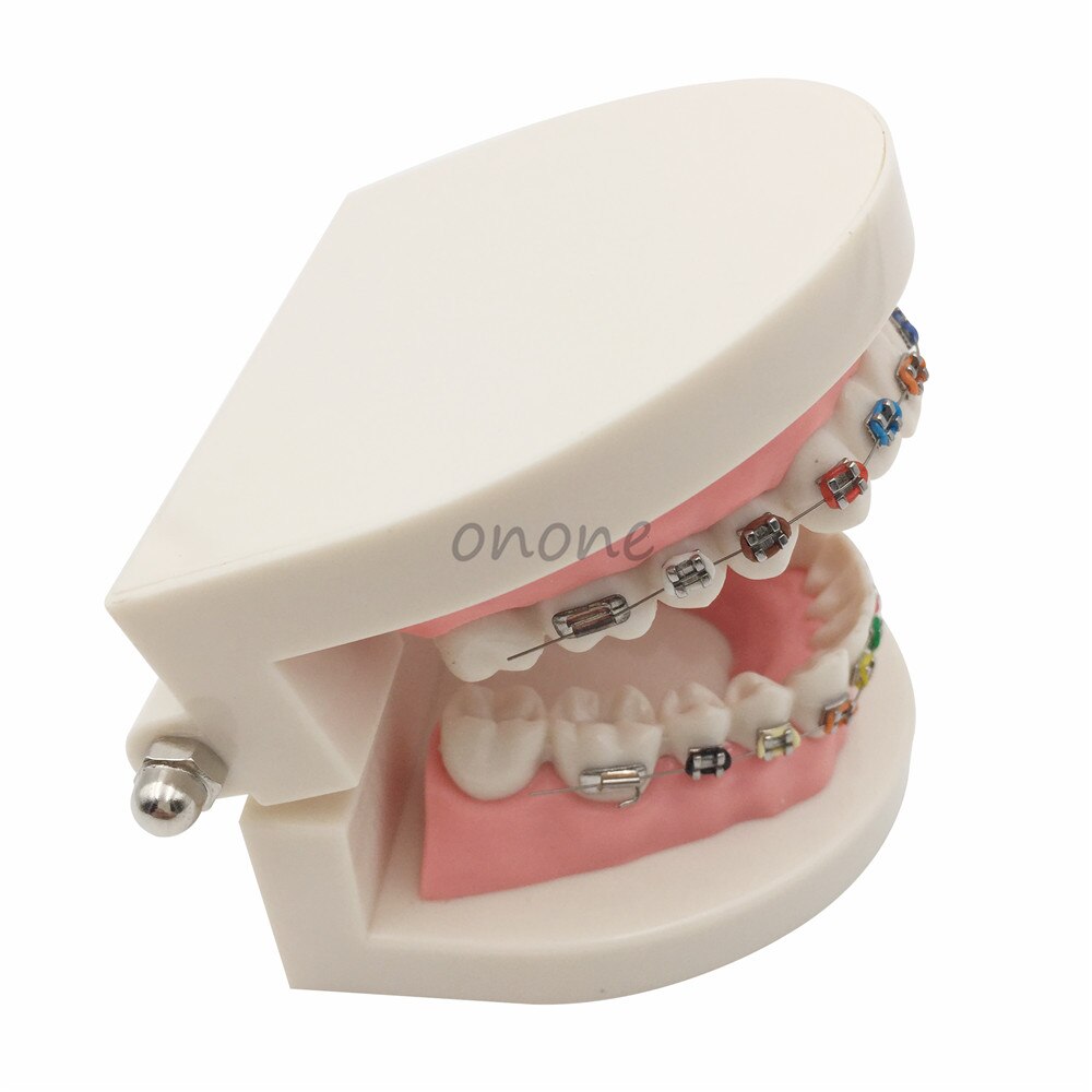 1pcs Orthodontics Model for Dentist Dental 1/2 Sta... – Vicedeal