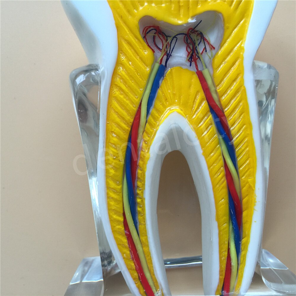 Dental Anatomical Molar Model molar inner structur... – Vicedeal