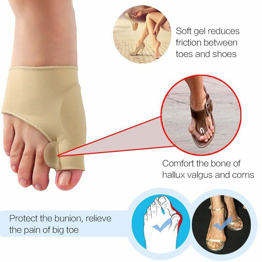 2 Pair Valgus Braces Big Toe Orthopedic Correction... – Grandado